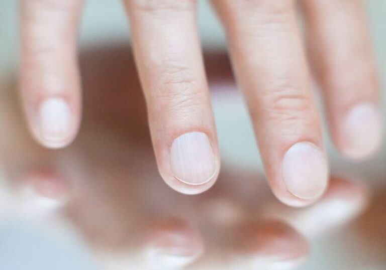 Nagelhaut kauen psychische Probleme: Ursachen und Lösungen