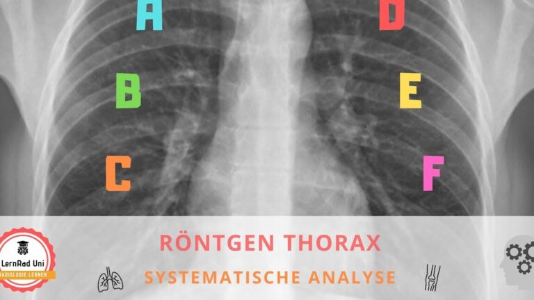 Röntgen Thorax Normalbefund: Merkmale und Interpretation